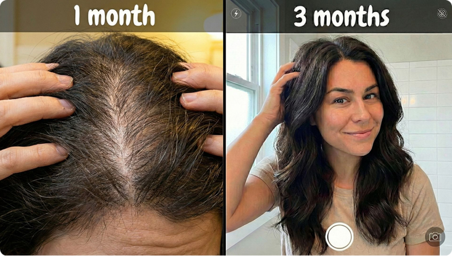 Best Hair Vitamins Of 2026 For Women Battling With Thinning, Graying ...